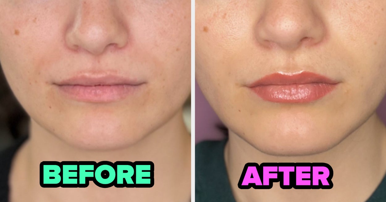 I Got My Lips Tattooed, And Here's How It Went