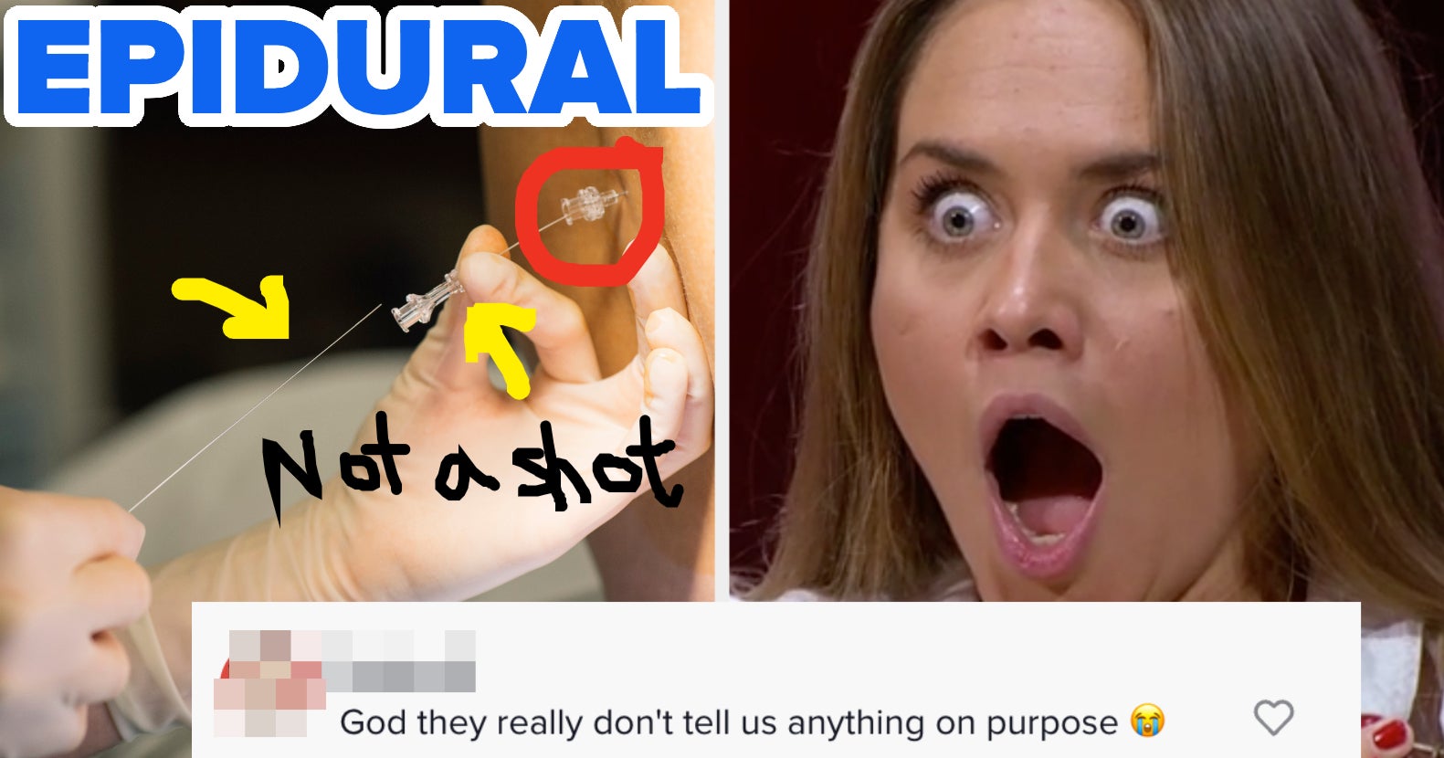 People On TikTok Learned That Epidurals Aren’t Needles