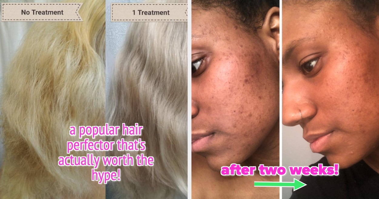 33 Face And Hair Treatments With Noticeable Results
