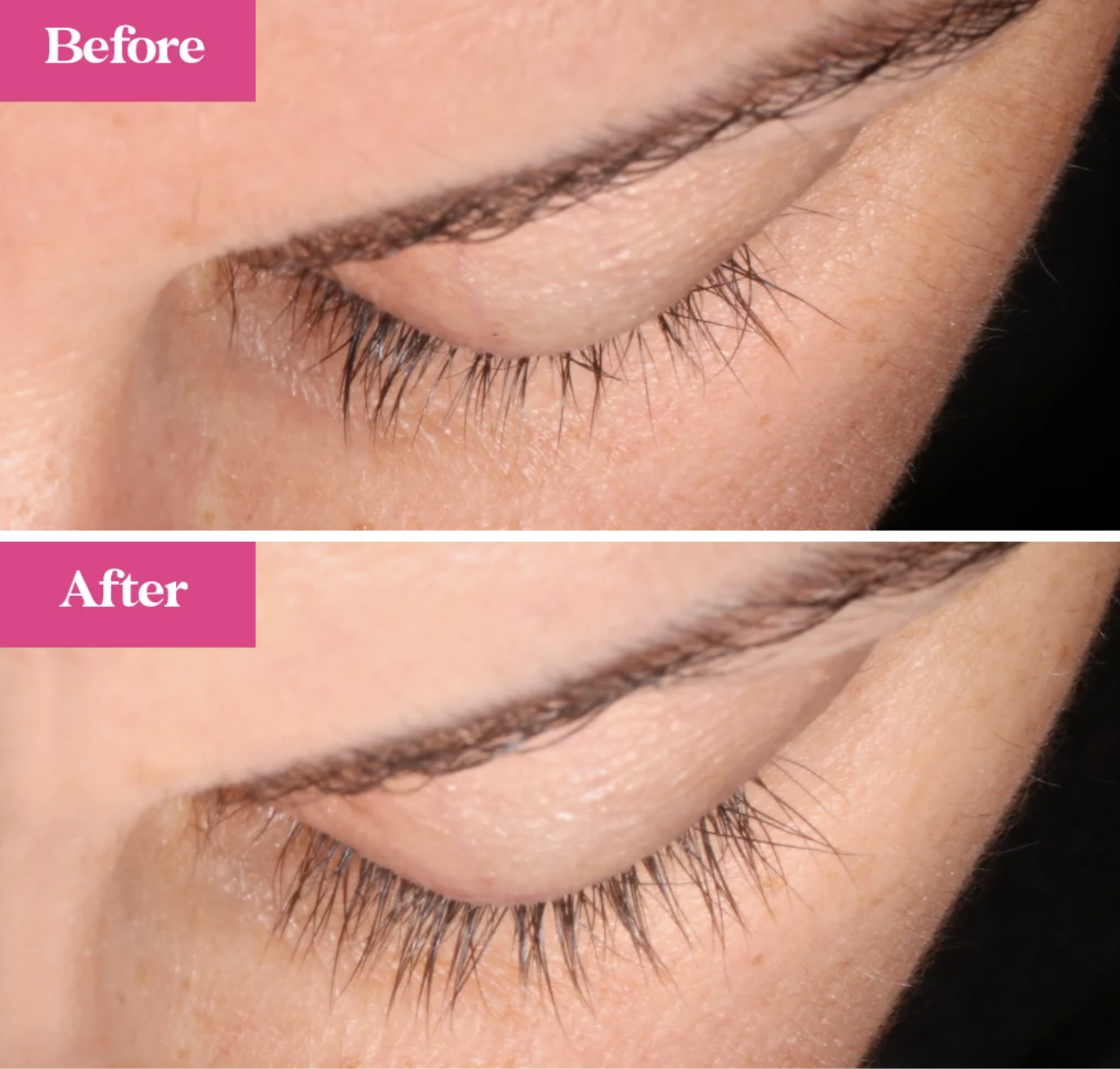 Grandelash Md Enhancing Serum Review Cnn Underscored Atelier Yuwaciaojp