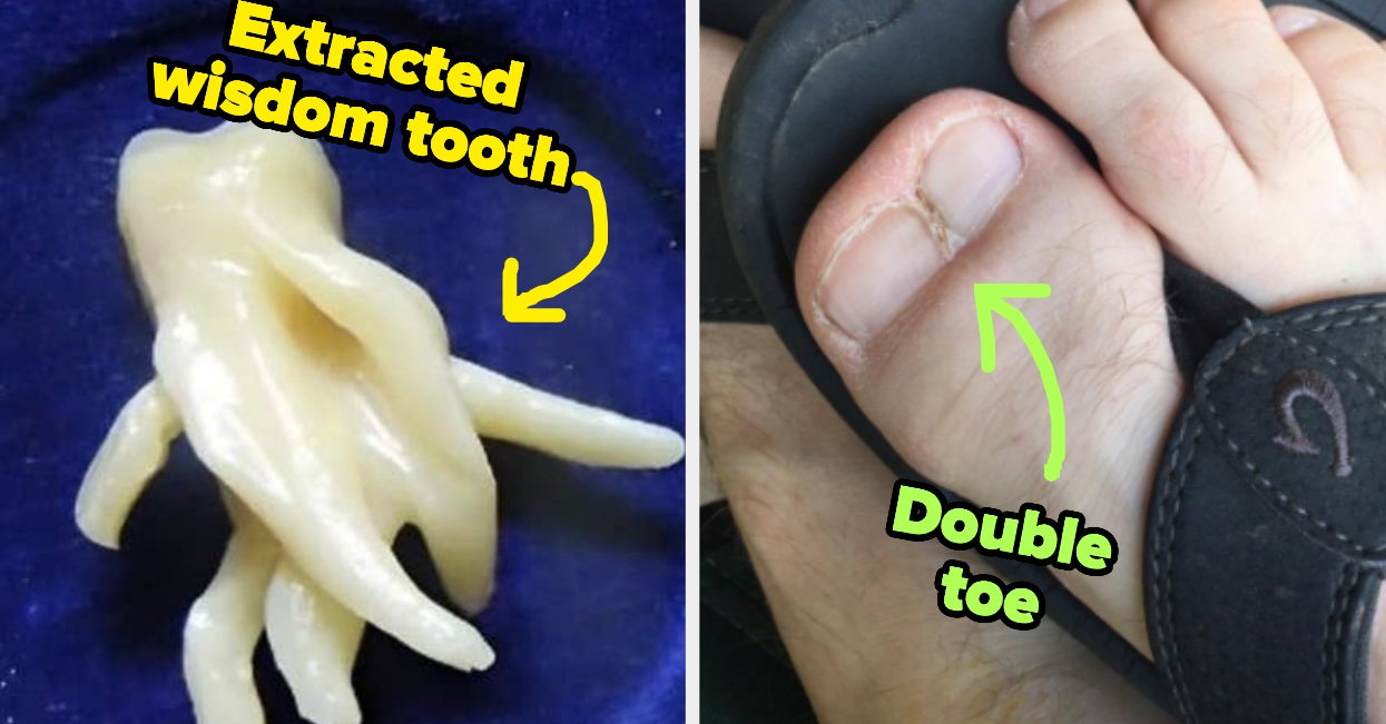 22 Super Unsettling Photos Of The Human Body