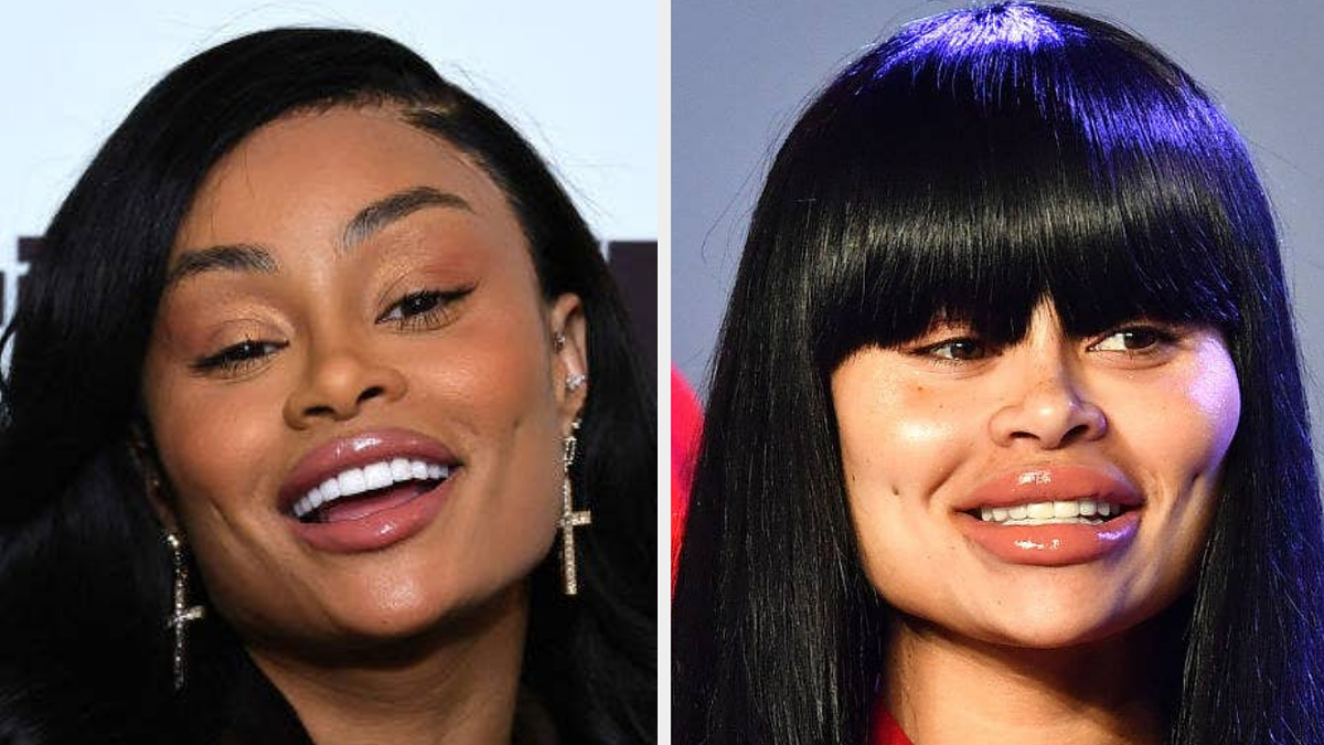 Blac Chyna Forehead Blac Chyna Forehead