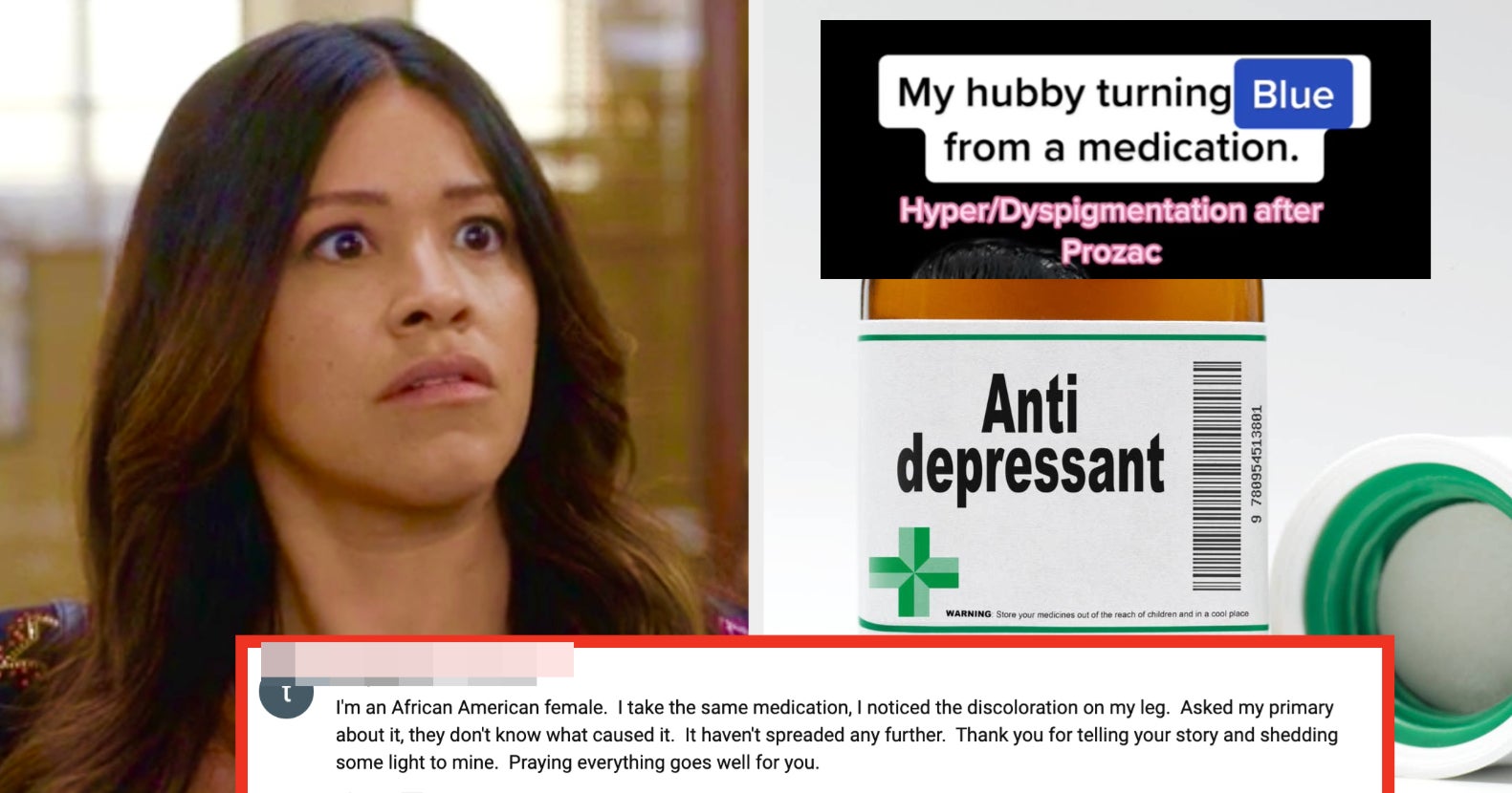 Antidepressant Causes Man's Skin to Turn Blue, Doctor Explains