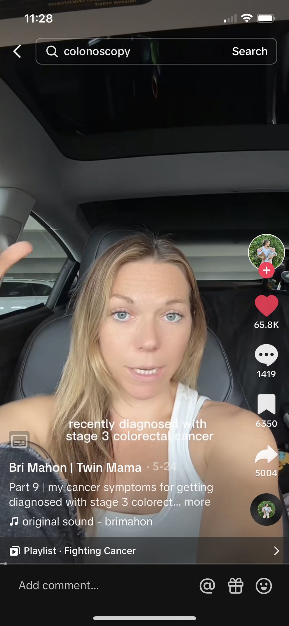 This 31-Year-Old Woman's Subtle Colon Cancer Signs