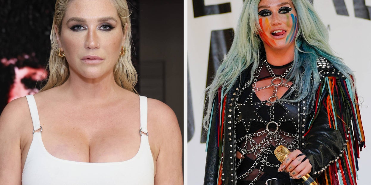 kesha before and after plastic surgery