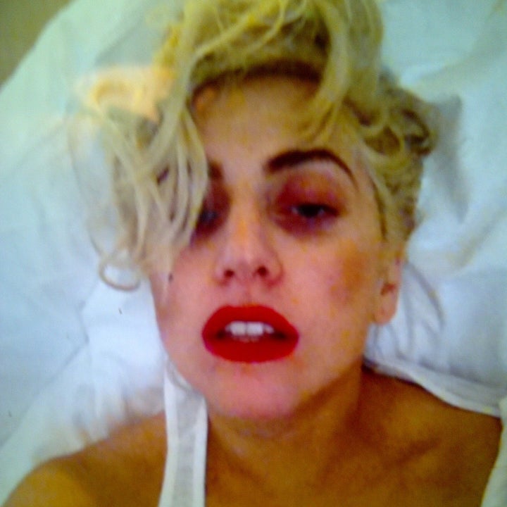 17 Famous Artists Injured During Their Concerts