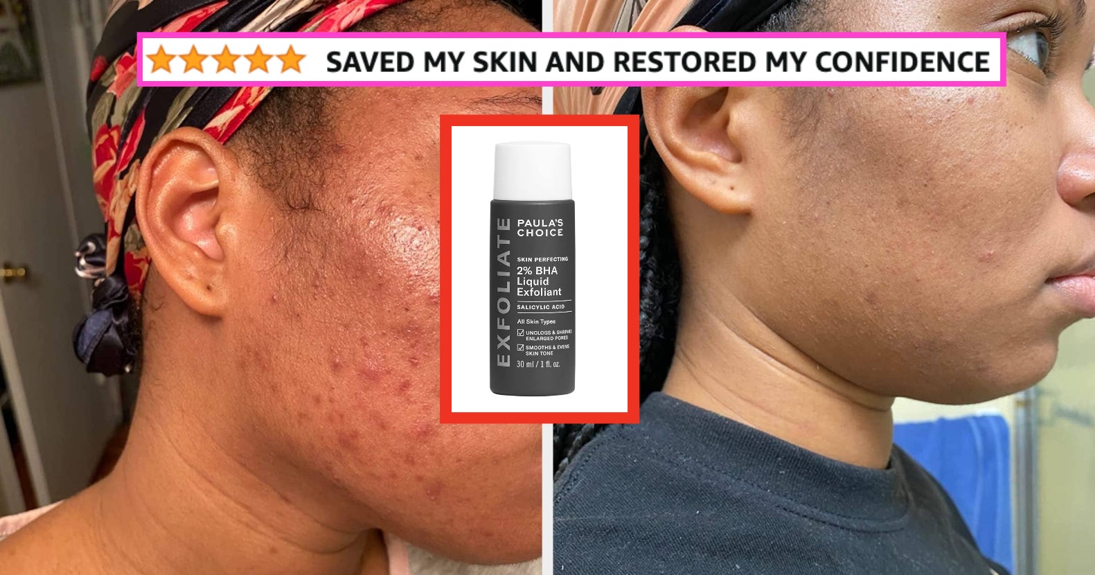 27 Best Amazon Skincare Products With 1,000+ 5-Star Reviews