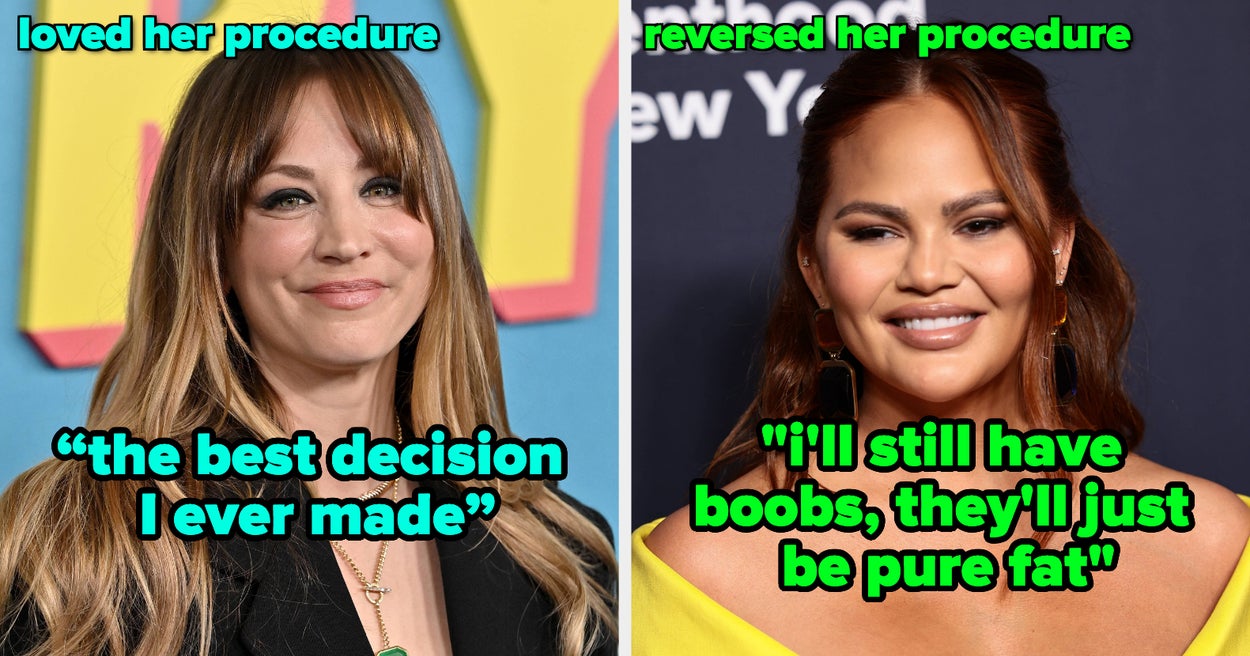 Celebs Who Embrace Cosmetic Procedures And Those Who Reversed Them