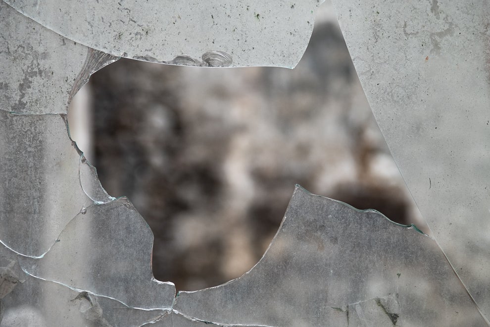 Reddit Shares Weird Scar Stories