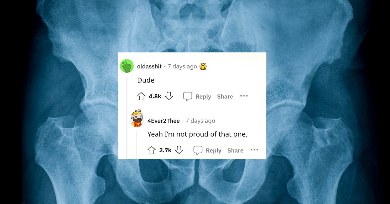 This Person Was Hospitalized For Not Pooping Enough