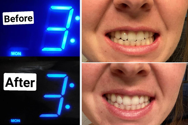 51 Products With Before-And-After Photos So Amazing You'll Be Tempted ...