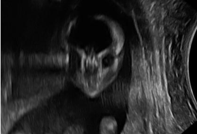 17 Things Dads-To-Be Need To Learn About Pregnancy