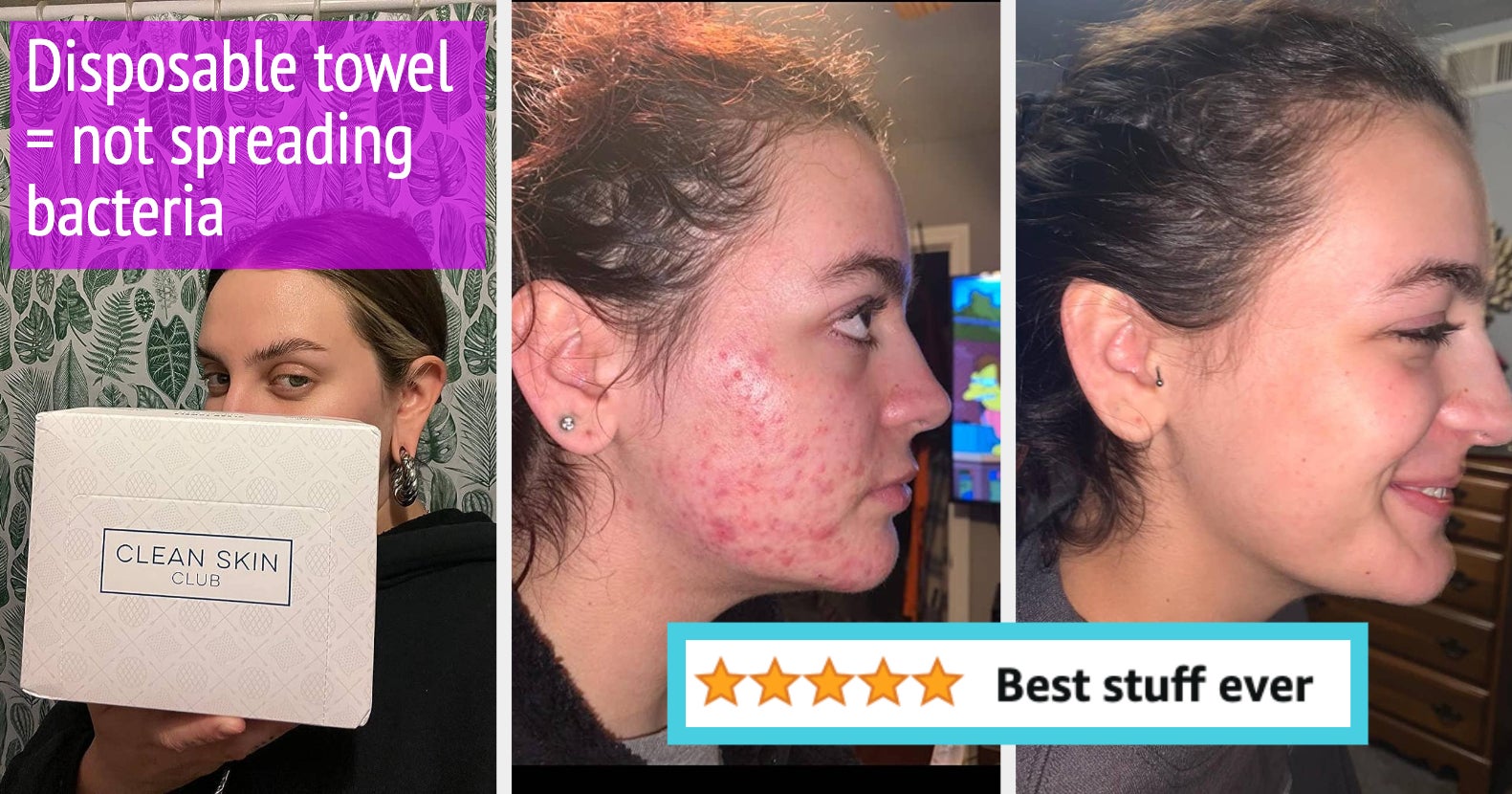 23 Products For Acne-Prone Skin