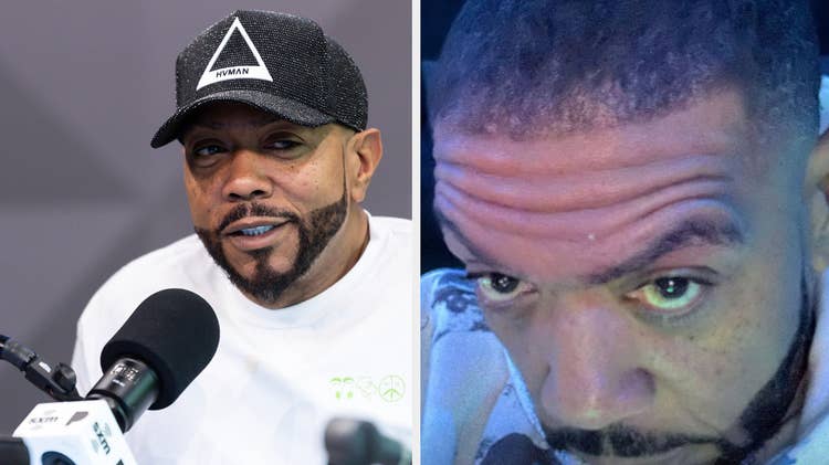 Hair Loss: Find The Latest Hair Loss Stories, News & Features