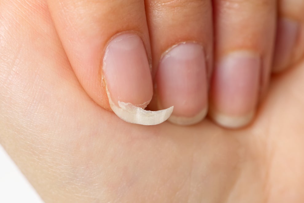 Common Nail Care Mistakes People Are Making