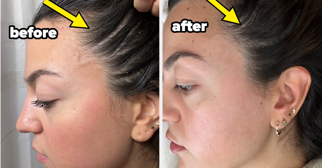 Hair Oiling: Centuries-Old Practice Taking the World By Storm