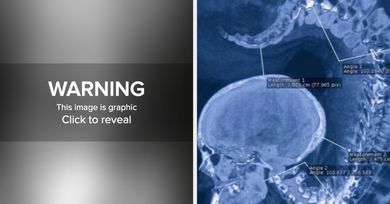 16 Unbelievable X-Ray Photos