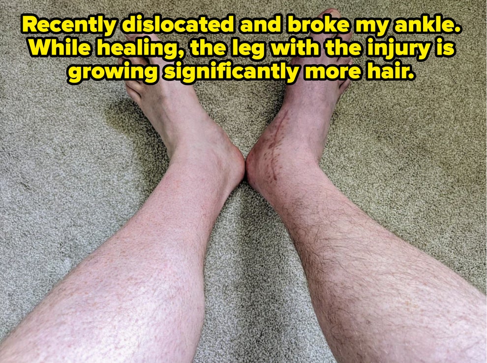 49 Completely Wild Photos Of The Human Body