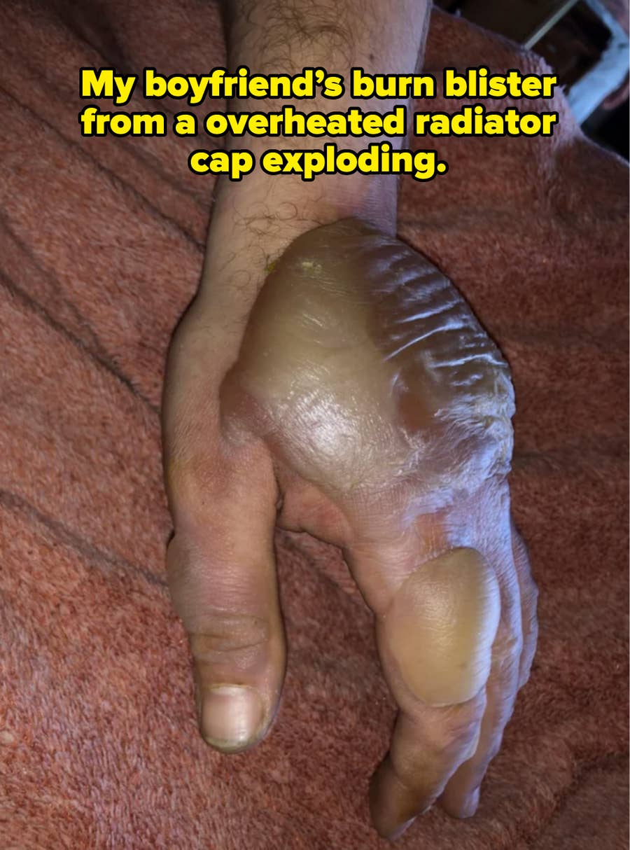 human abnormalities pictures