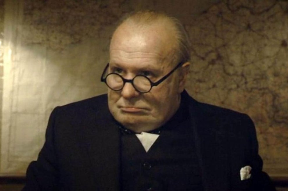 25 Actors Who Got Seriously Injured While Filming