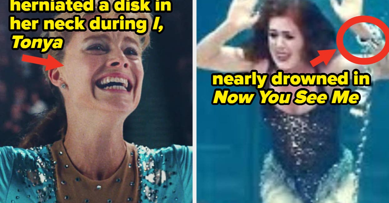 25 Actors Who Got Seriously Injured While Filming