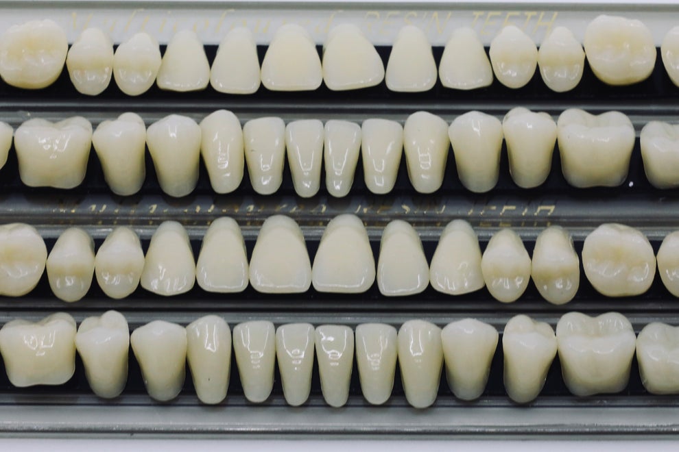 29 Rare Body Abnormalities People Live With