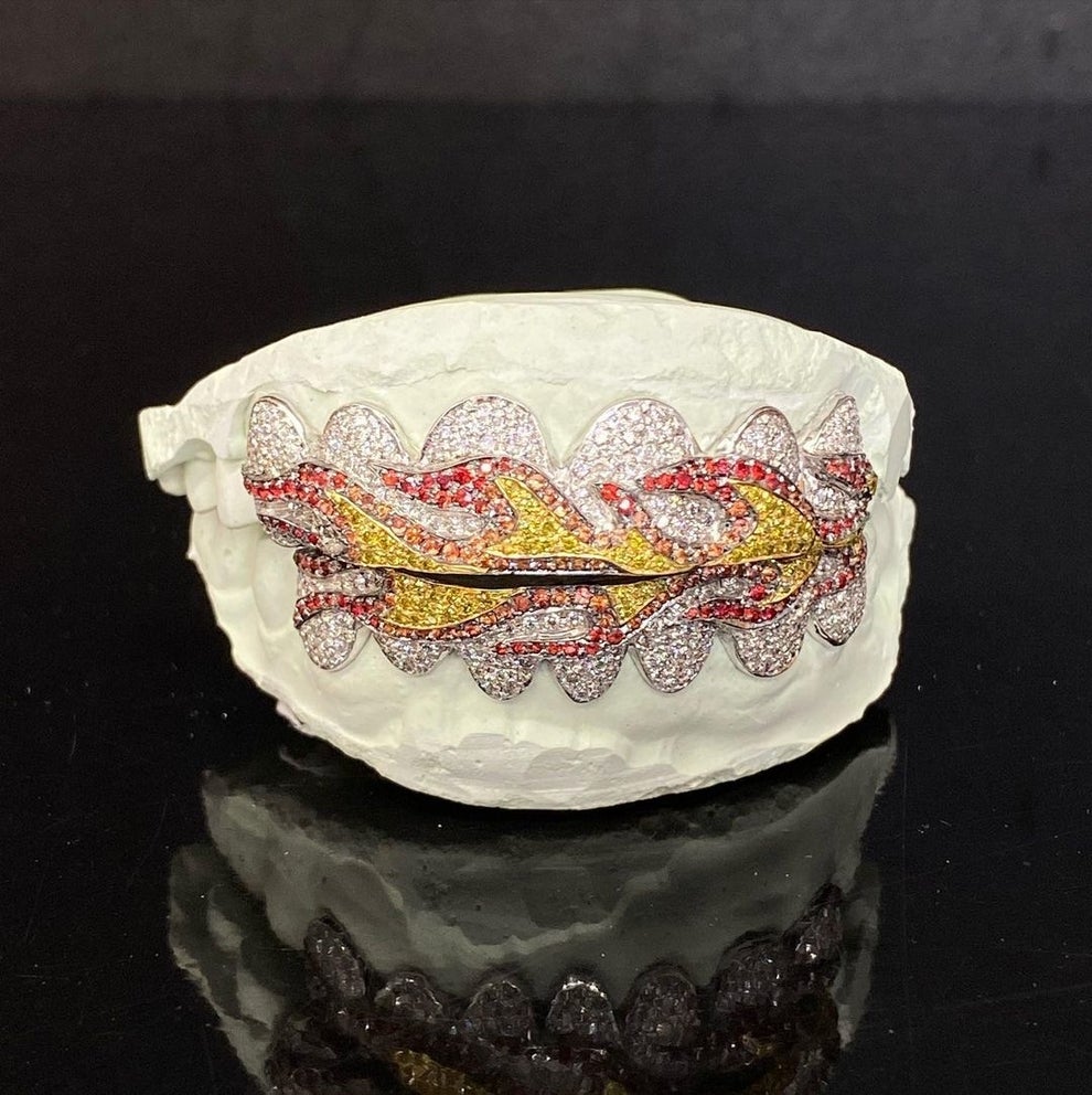 ASAP Rocky Grills By Grillz Jewelz Tetsuya Akiyama | Complex