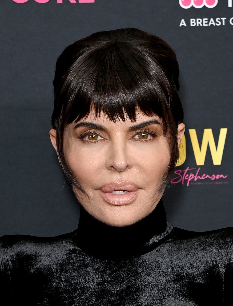 Lisa Rinna Reacts To Criticism Of Excessive Face Filler