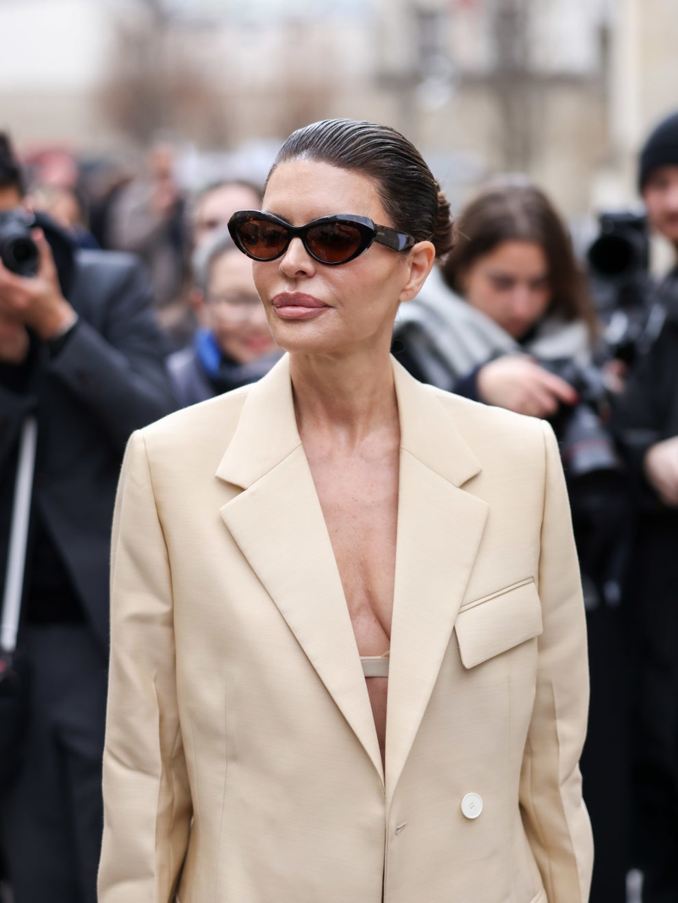 Lisa Rinna Reacts To Criticism Of Excessive Face Filler