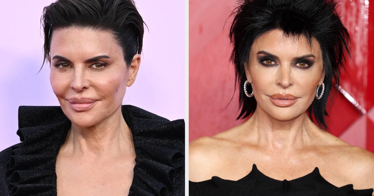 Lisa Rinna Reacts To Criticism Of Excessive Face Filler