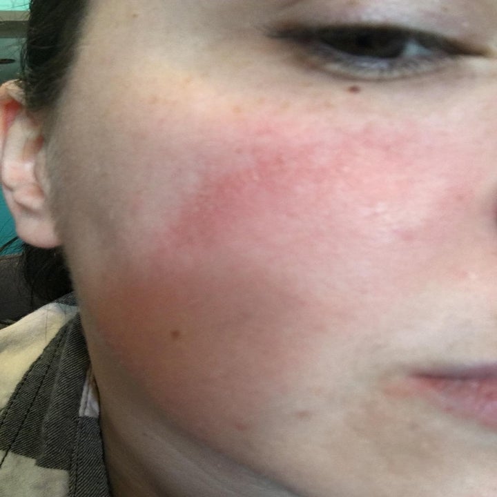 21 Skincare Products From Amazon That Reviewers Swear Help With Redness
