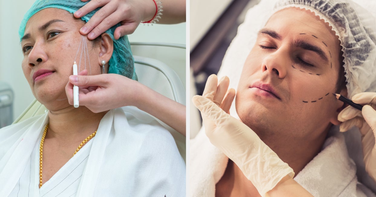 Let Us Know How Plastic Surgery Changed Your Life