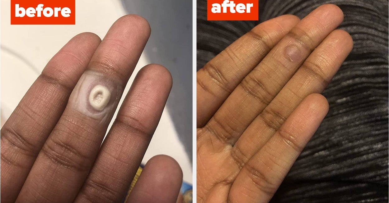 30 Products To Help Solve Common (Yet Embarrassing) Problems