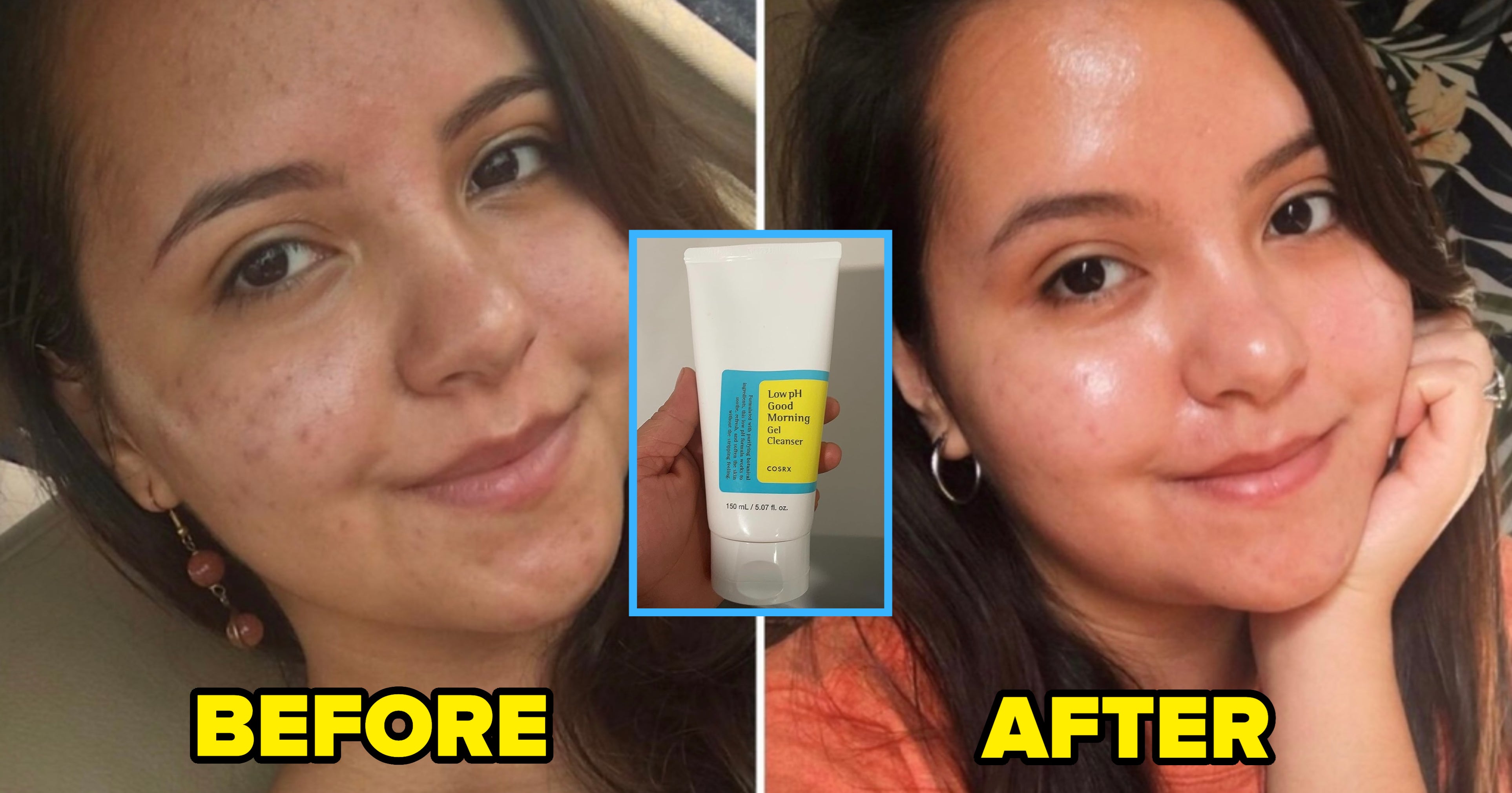 26 K-Beauty Products With Jaw-Dropping Result Photos