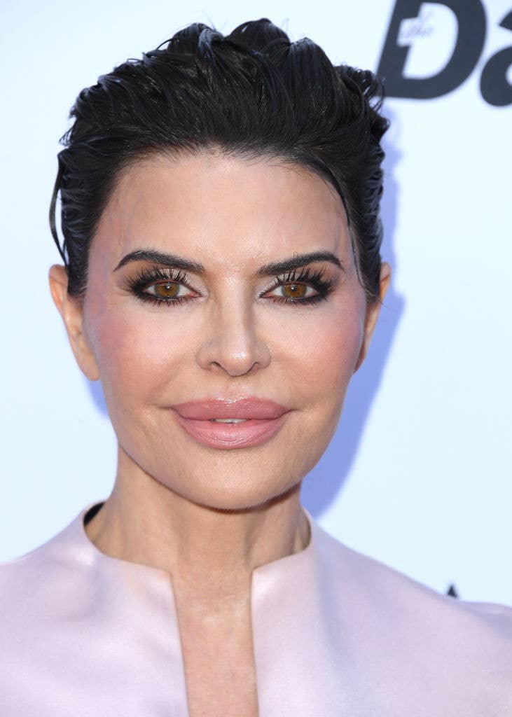 Celebrity Cheek Fillers Before And After 60 Photos - Moonagedaydream.film