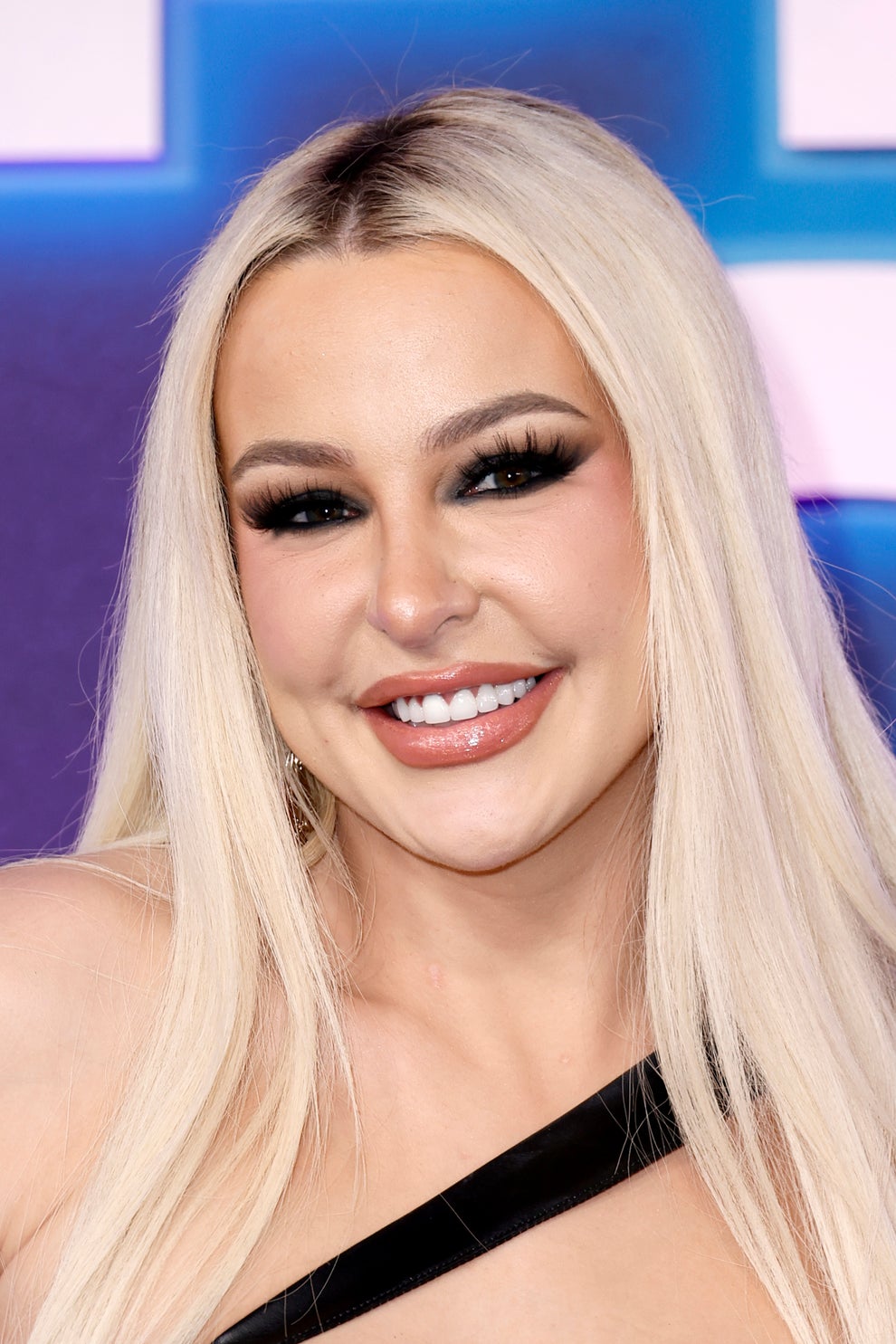 Celebrities With Veneers