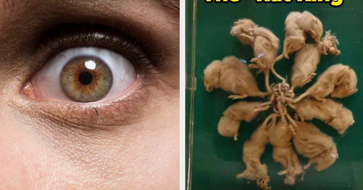 27 Extremely Disturbing Wikipedia Pages That Will Haunt Your Dreams ...