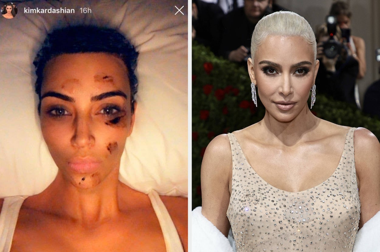 kim kardashian psoriasis makeup