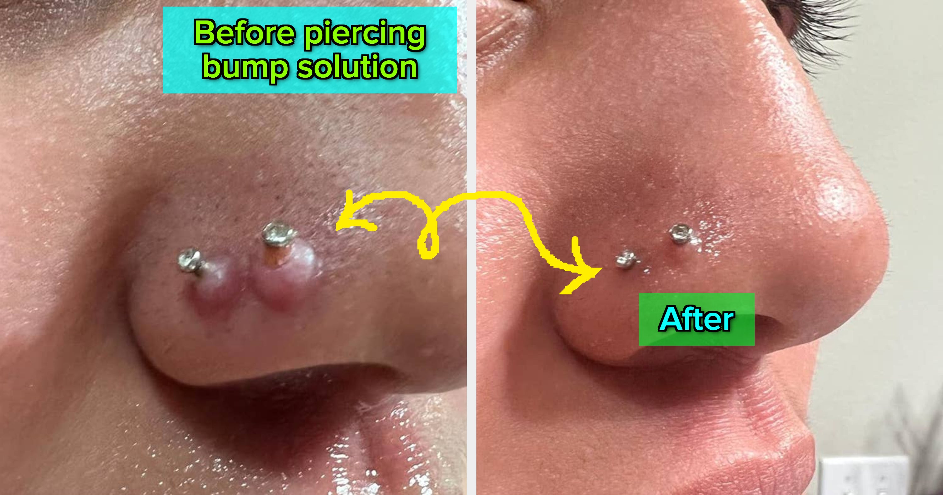 changing nostril piercing