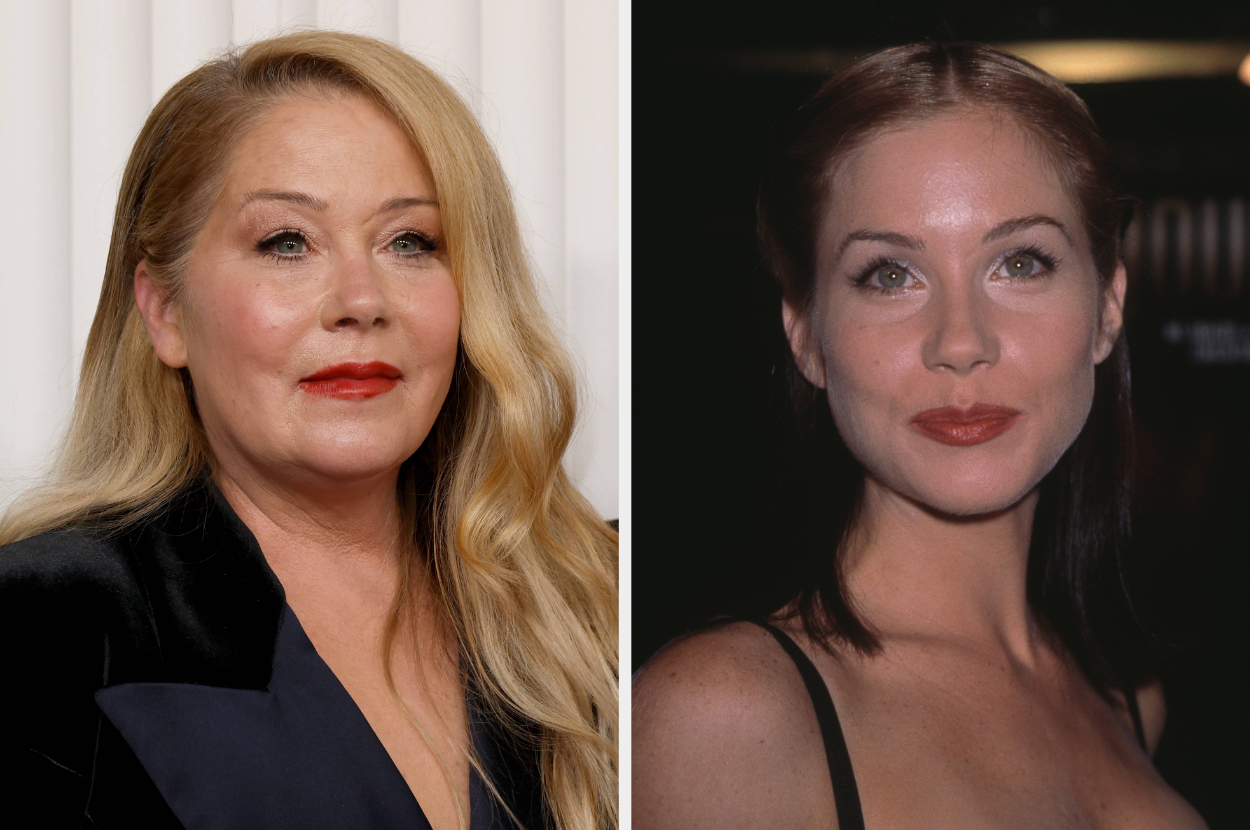 Christina Applegate After Surgery