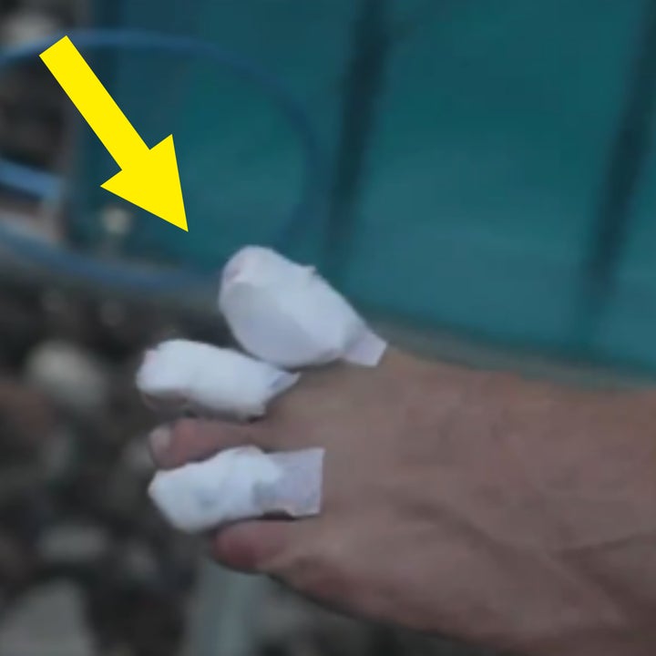 Colin Jost's 2024 Paris Olympic Games Foot Injury