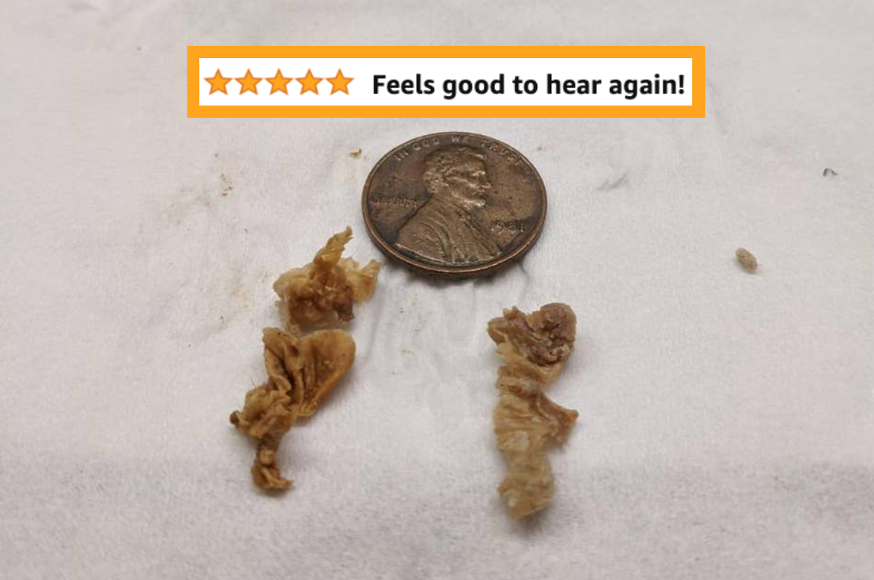 "The Immediate Results Were Disgusting": 40 Products With Such Mind ...