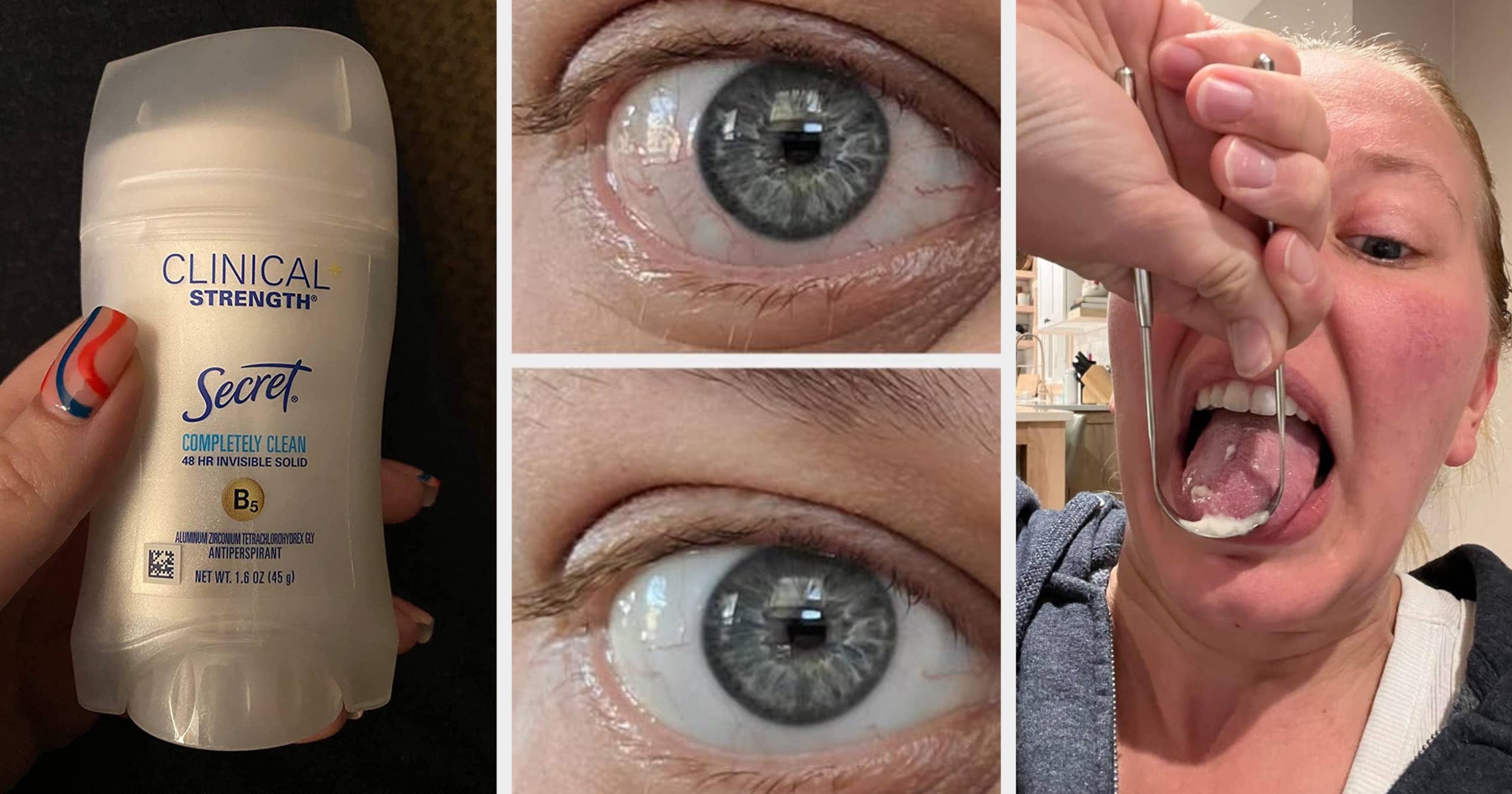 26 Things To Help With Sorta Embarrassing Problems