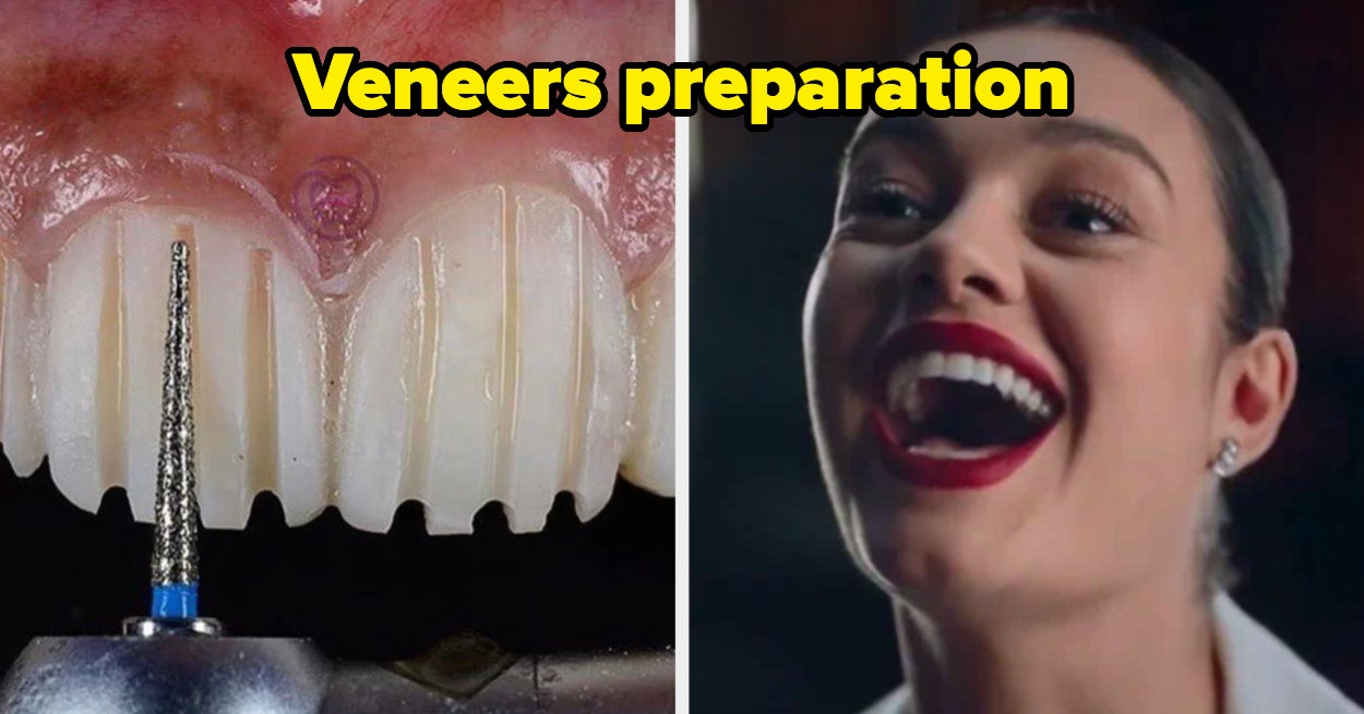 14 Skin Crawling Photos That Made My Soul Leave My Body