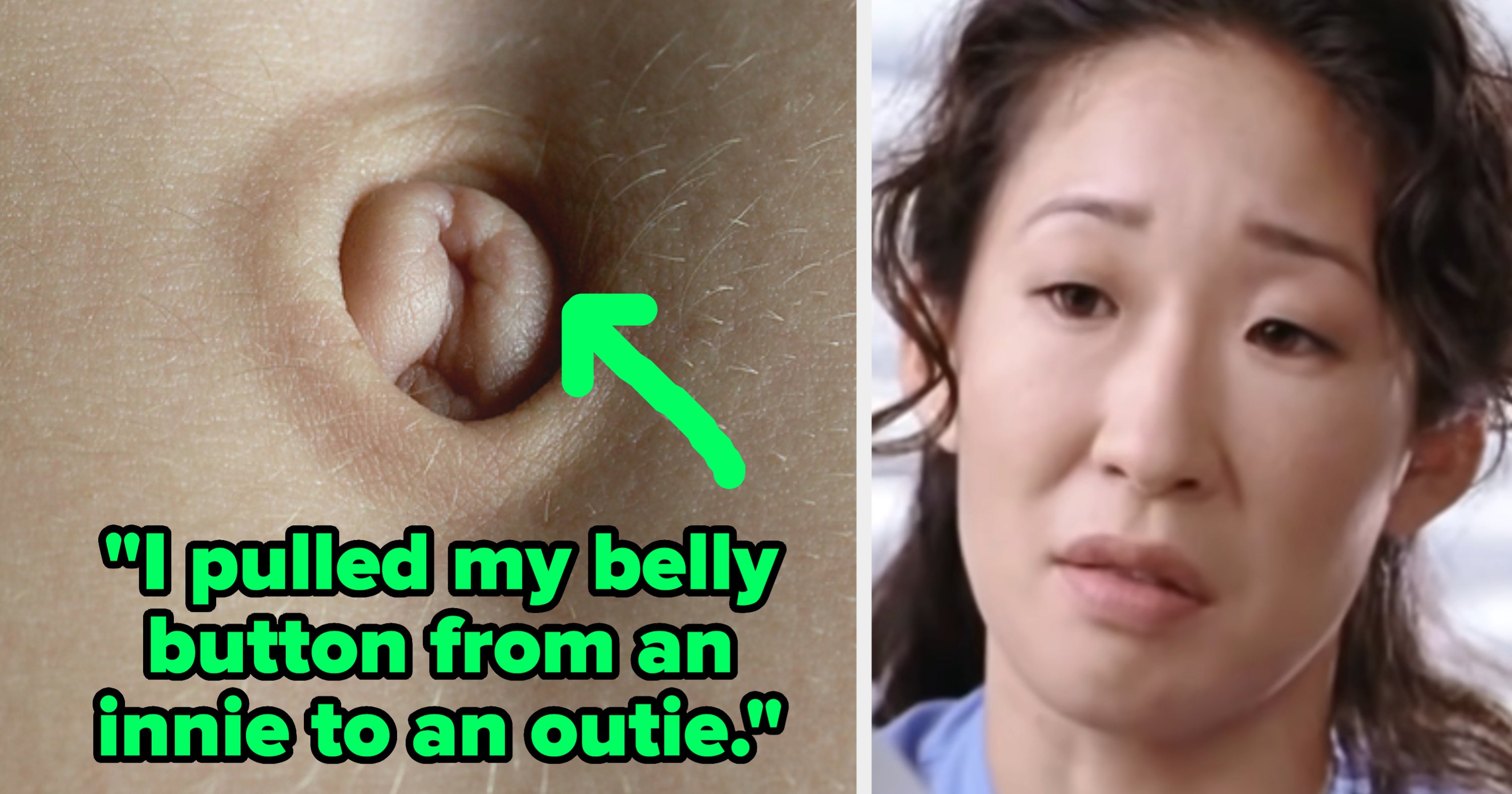 39 Body Abnormalities People Revealed They Have