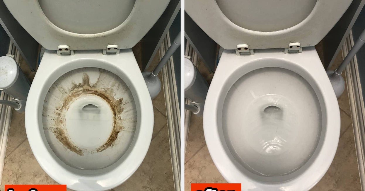 35 Solutions To The Gross Problems That Follow You