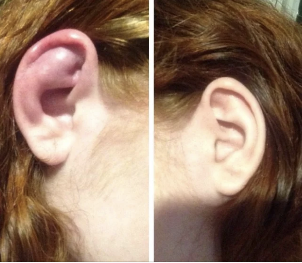 51 Absolutely Fascinating Photos Of The Human Body