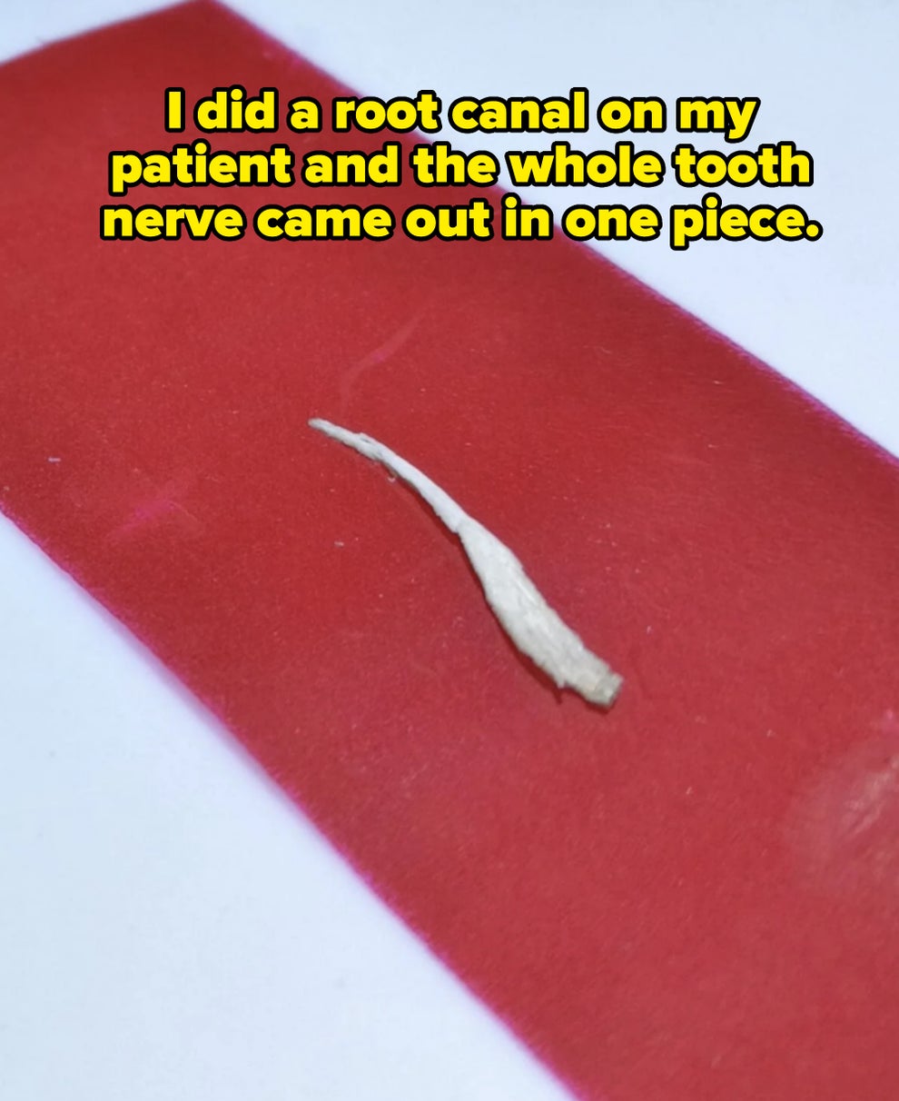 51 Absolutely Fascinating Photos Of The Human Body