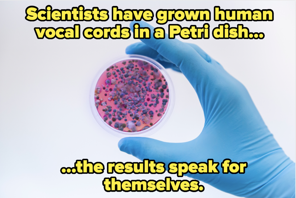 33 Hilariously Cheesy Puns That Are Absolutely Grate