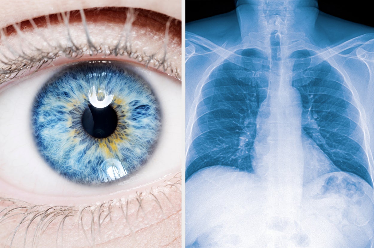 human abnormalities pictures